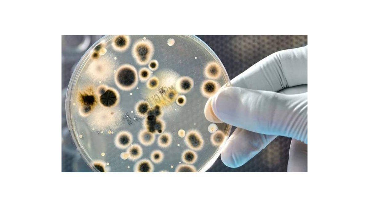 Ya son 5 los fallecidos por la bacteria: cuatro menores y un adulto