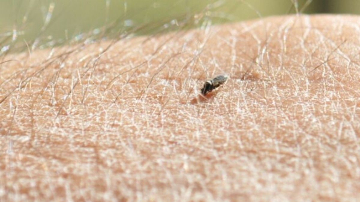 Preocupación por los barigüíes en Buenos Aires: No es común que ...